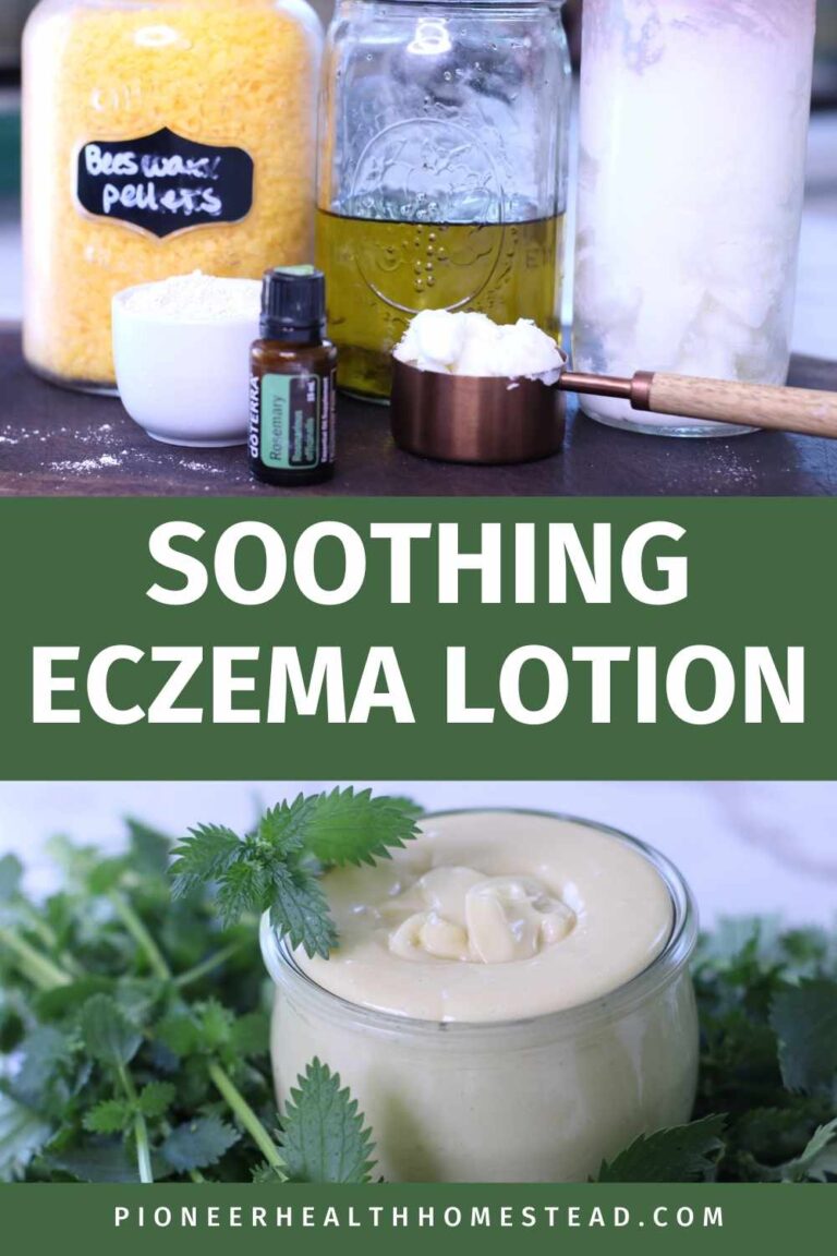 The Best Nettle Lotion Recipe - Pioneer Health Homestead